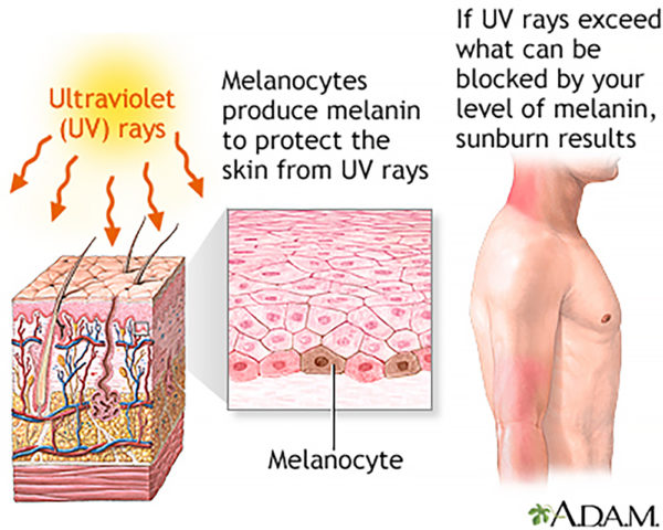 Infographic: Sunburn, Sunscreen, and SPF | RECOIL OFFGRID