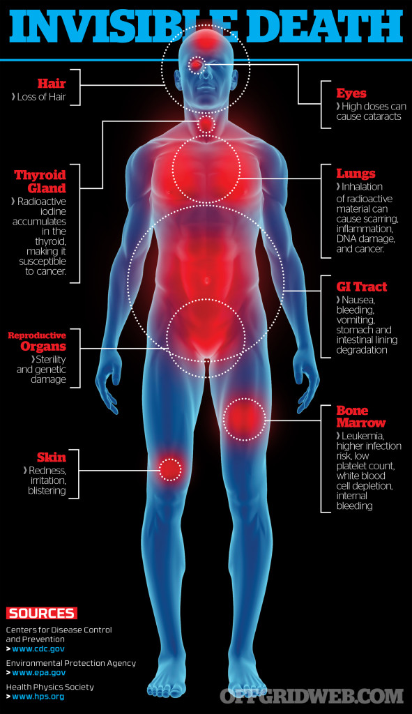 Invisible Death: Acute Radiation Syndrome | RECOIL OFFGRID