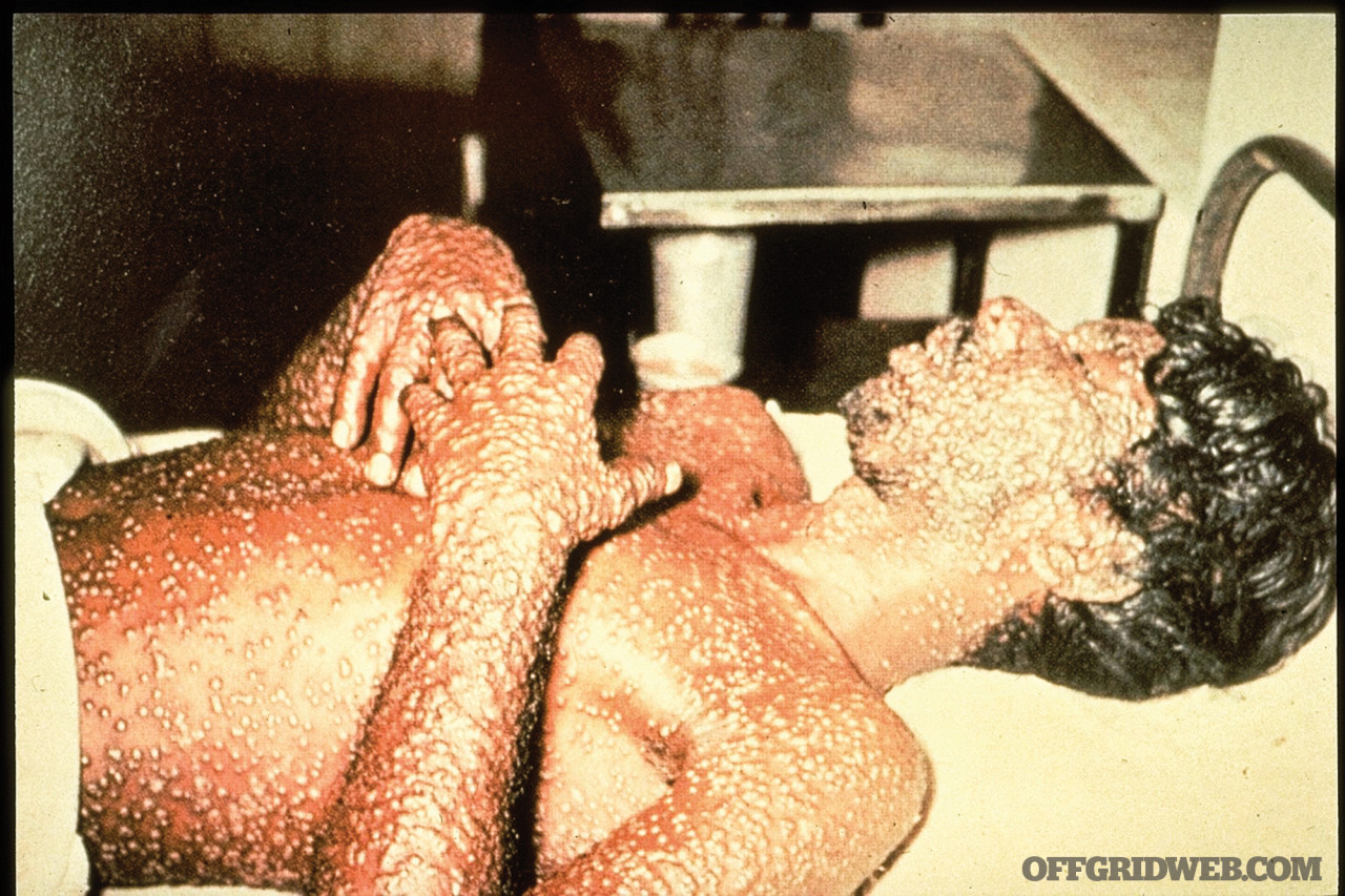Operation Dark Winter: Weaponized Smallpox | RECOIL OFFGRID