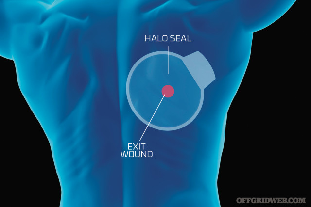 Plug 'Em Up: Puncture Wound First Aid | RECOIL OFFGRID