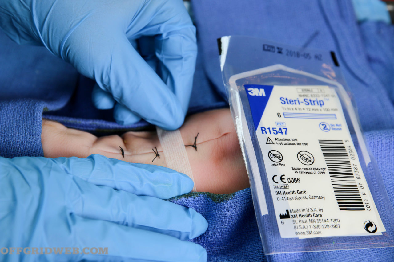 How to Suture: DIY Guide to Wound Closure Methods | RECOIL OFFGRID