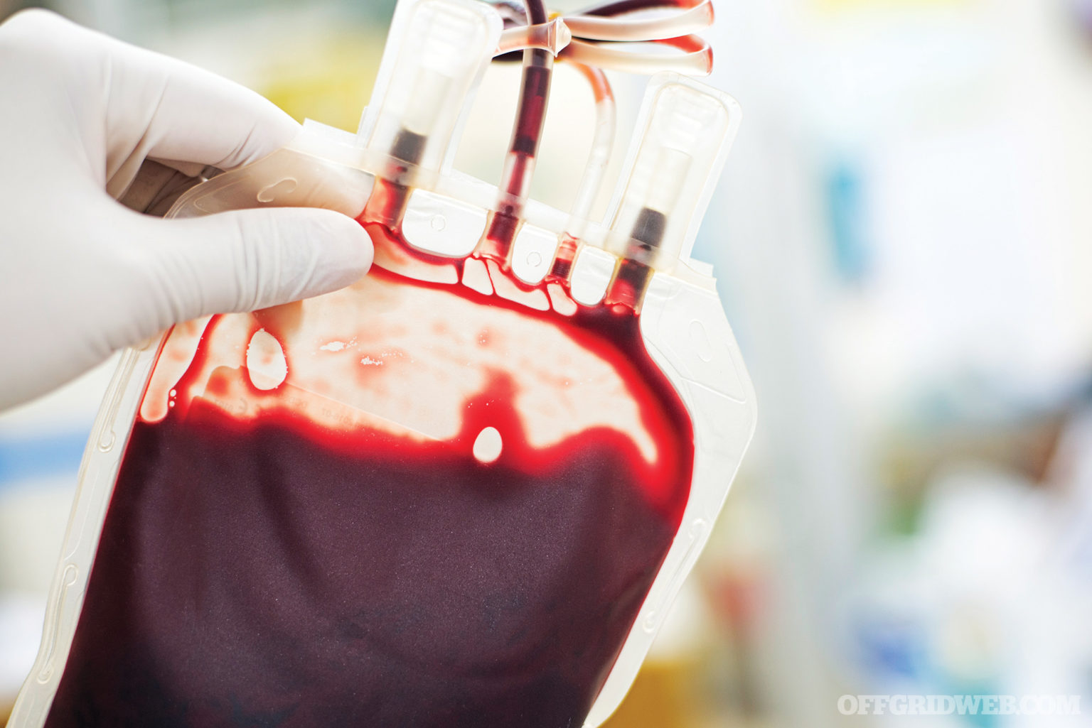 The Basics of IV Fluids for Emergency Scenarios | RECOIL OFFGRID