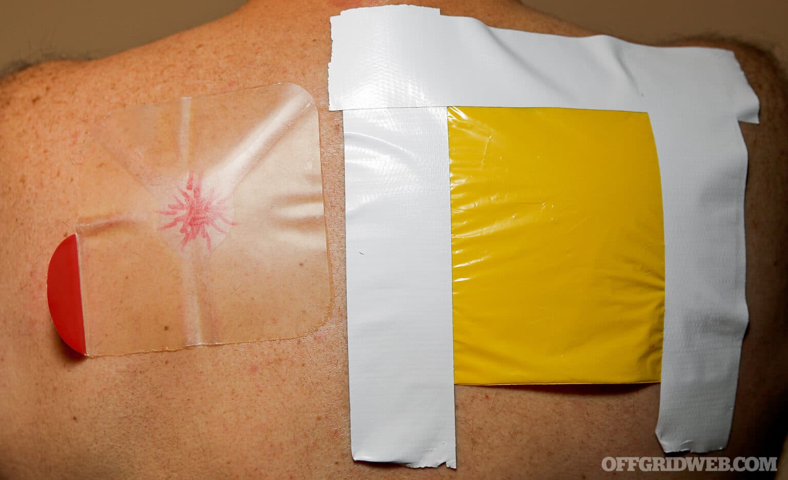 How to Treat Penetrating Chest Wounds | RECOIL OFFGRID