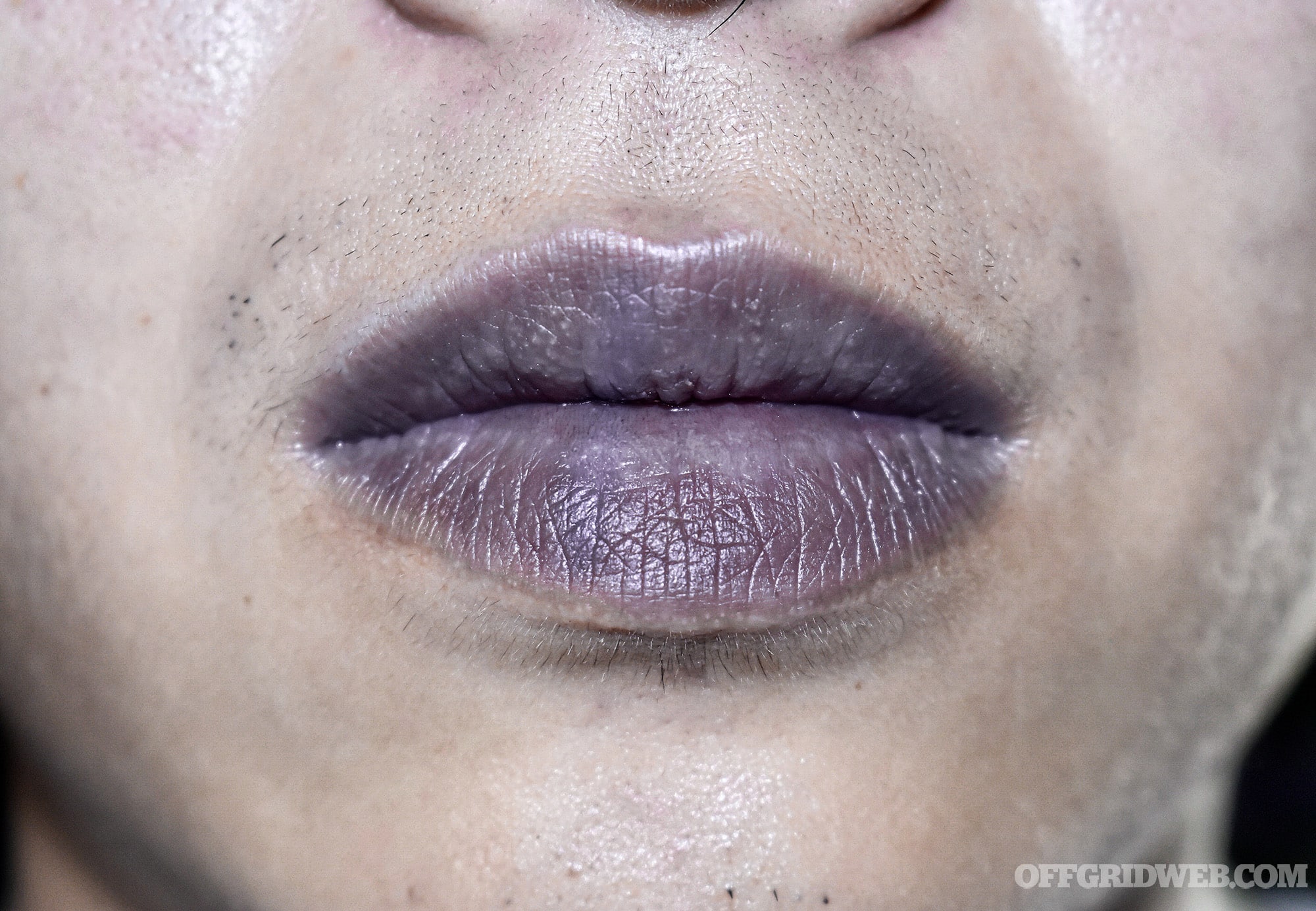 How to Treat Penetrating Chest Wounds | RECOIL OFFGRID