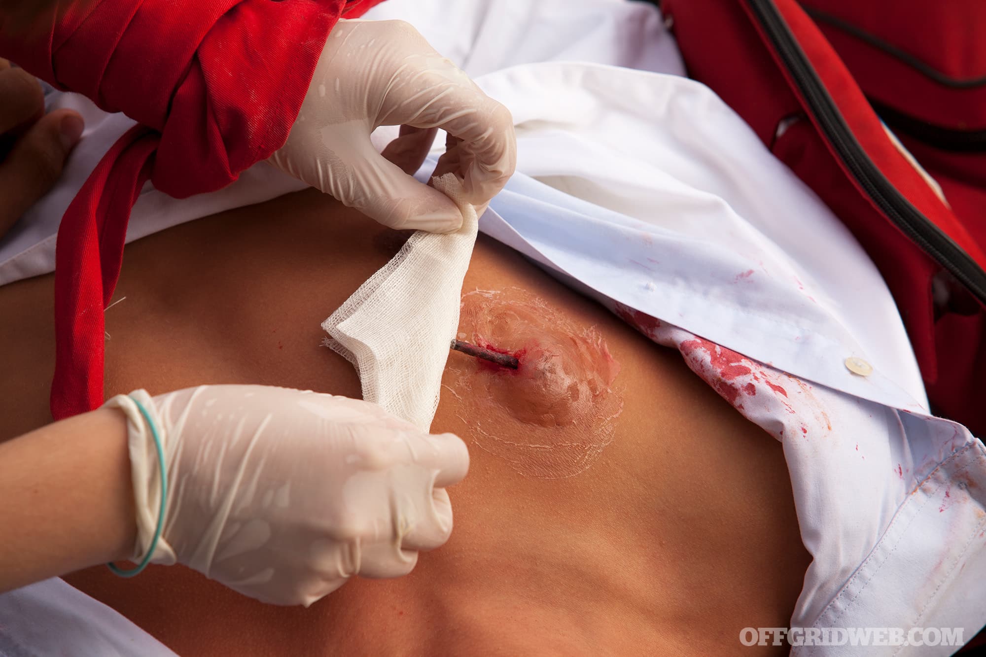 Traumatic Injury: Wounds of War | RECOIL OFFGRID